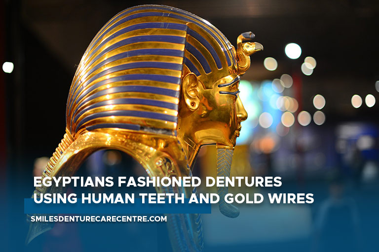 The Intriguing History of Dentures - Smiles Denture Care Centre